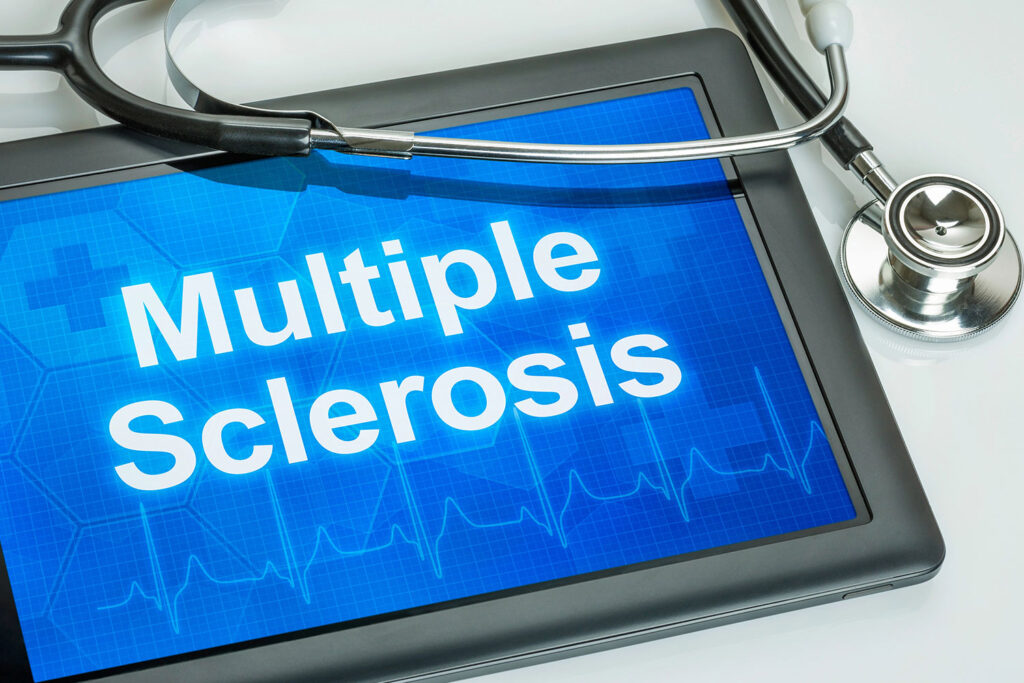 World MS Day: Why Is Multiple Sclerosis So Difficult to Diagnose ...